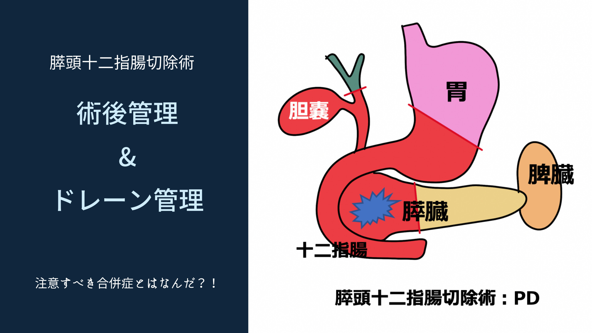 今さら聞けない!事例で考える意識レベルの評価方法|看護師のためのスキマ学習サイト